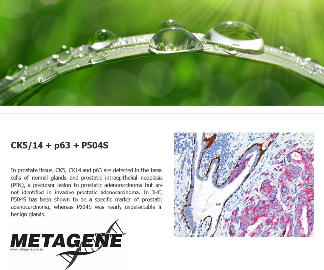 MetaGene – Horizon Discovery Group